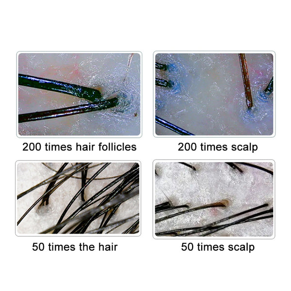 10 Inch LCD Scalp Detector Digital Hair Skin Analyzer Microscope for H ...