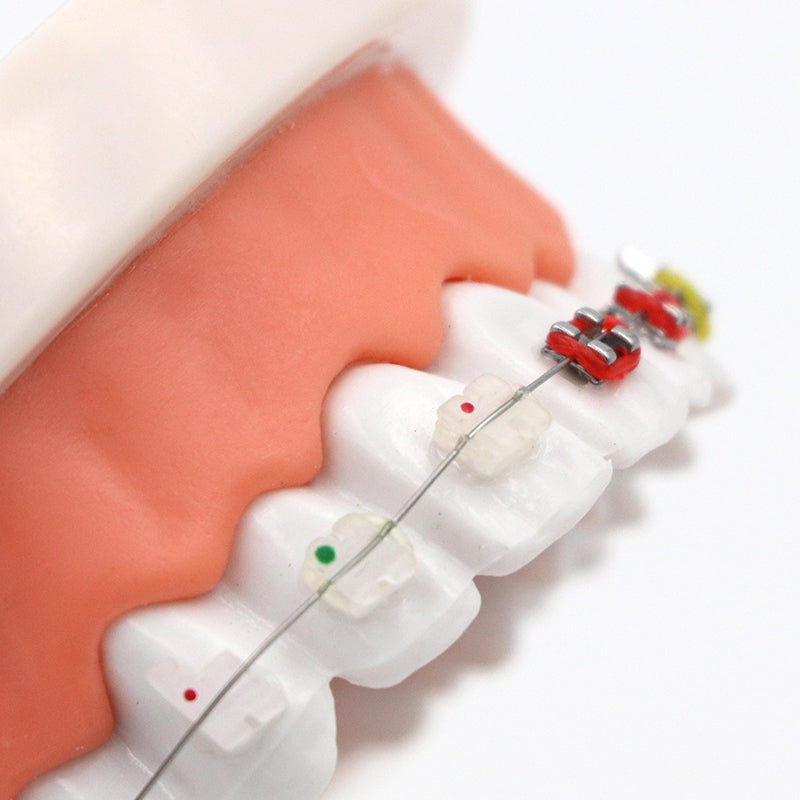 Dental Orthodontic Treatment Model With Ceramic Bracket Arch Wire Orth ...